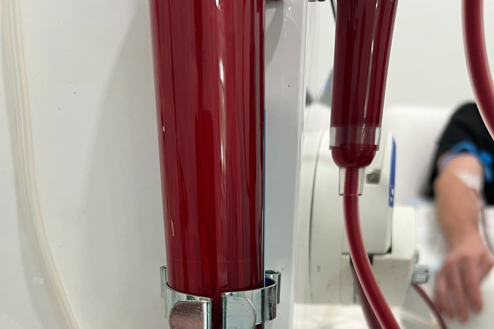 EBOO (Extracorporeal Blood Oxygenation and Ozonation) | The Remedy Room